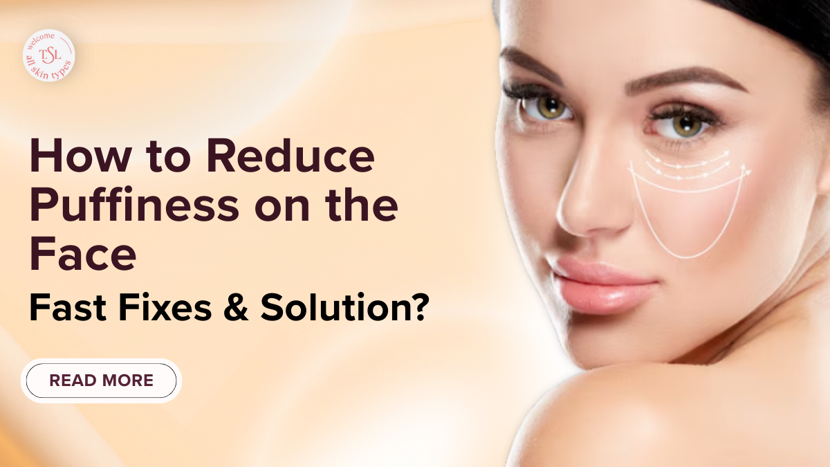 How to Reduce Puffiness on the Face: Fast Fixes & Solution? – The Skin ...