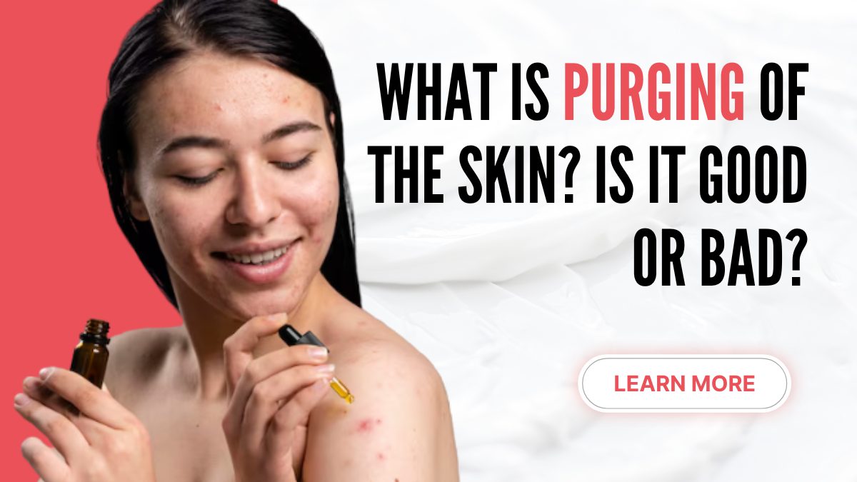 What Is Purging of the Skin? Is it Good or Bad? – The Skin Lab Skincare